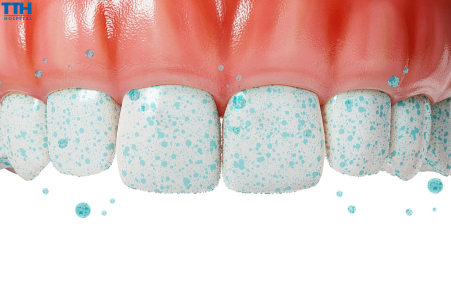 Thành Phần Của Vecni Fluor: Bí Quyết Bảo Vệ Sức Khỏe Răng Miệng